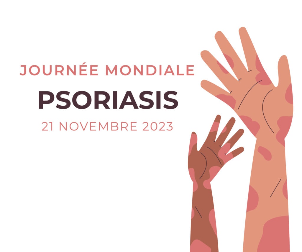 Journée mondiale du Psoriasis - Hôpital Paris Saint‑Joseph